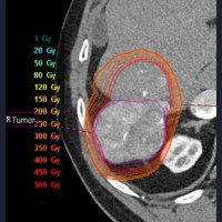 Curriculum Vitae – Zach Berman MD